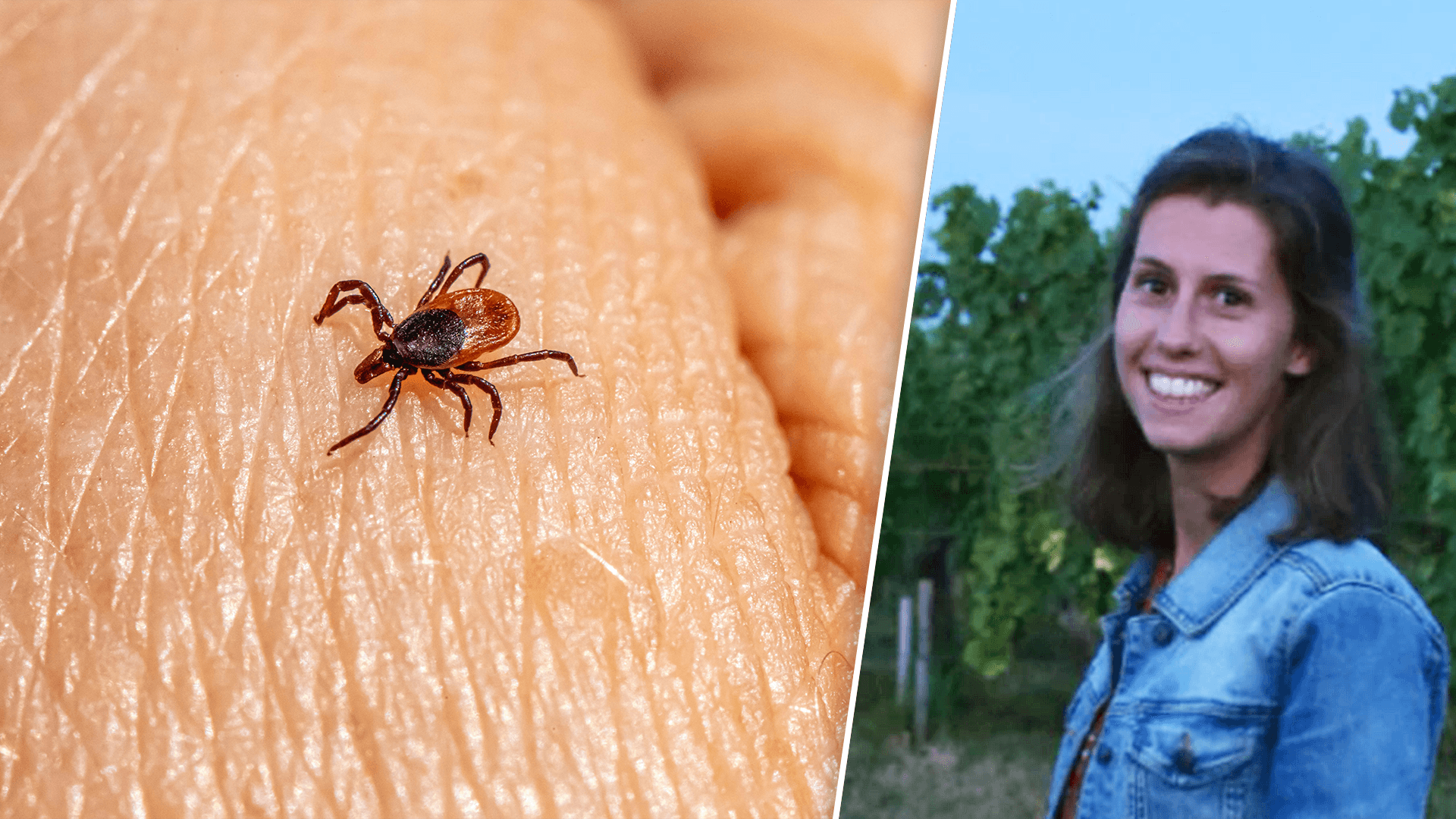Niet elke insectenbeet is onschuldig. Huisarts legt uit waar je op moet ...